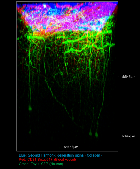 IVIM Technology Application Note_Oct. 2024